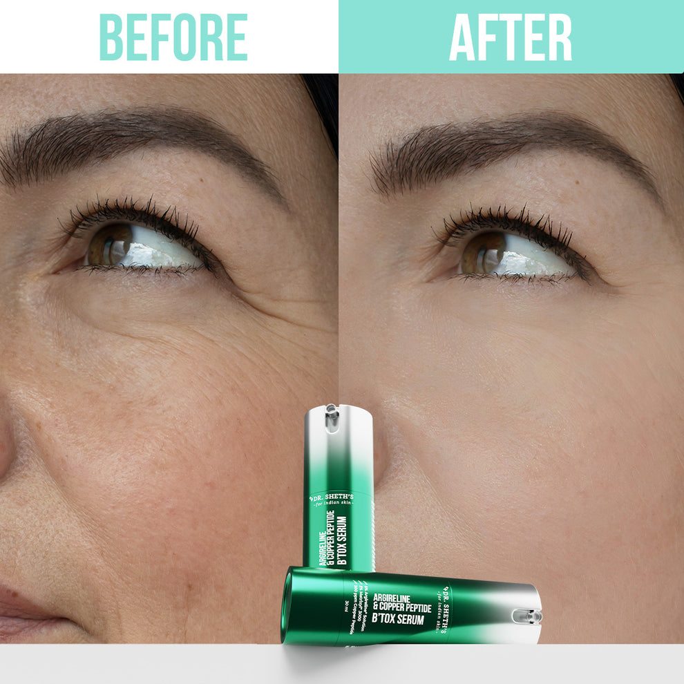 Argireline & Copper Peptide B’tox Serum - 30ml – Dr Sheth's